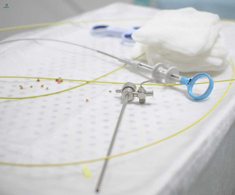 In-Office Cystoscopy – Lakeview Center for Urology