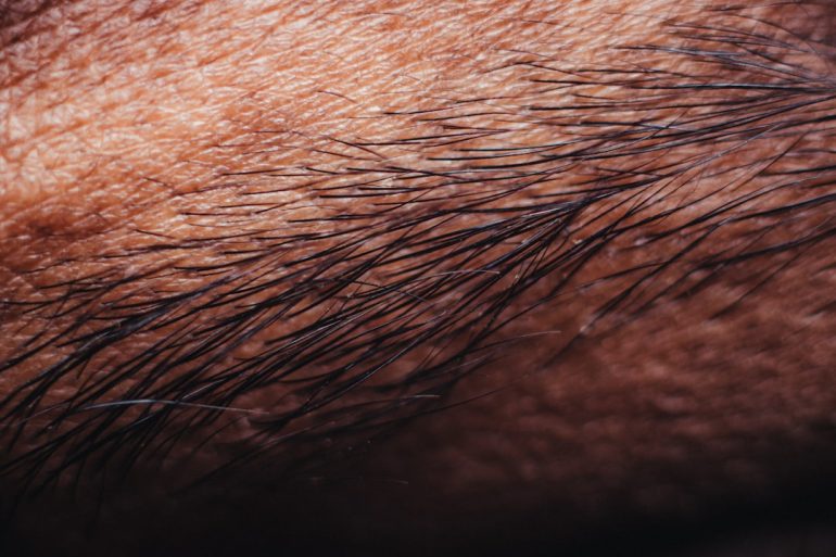 The Ultimate Guide to Vasectomy: Separating Fact from Fiction ...